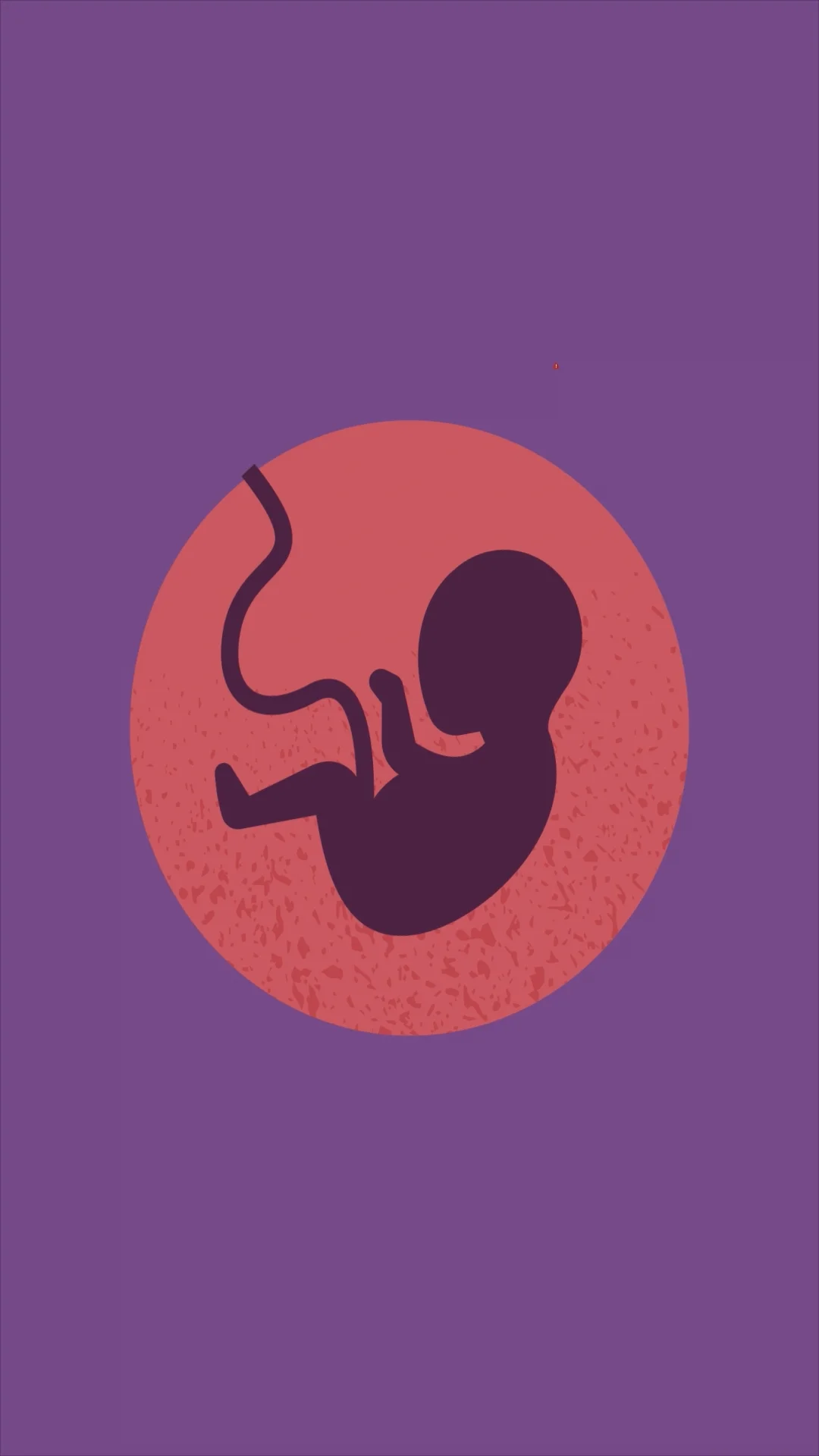 03-Still Birth Animation - Timing of birth - Tigrinya