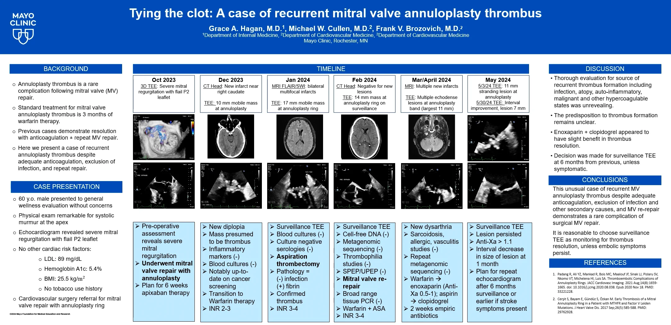 Tying the clot: A case of recurrent mitral valve annuloplasty thrombus ...