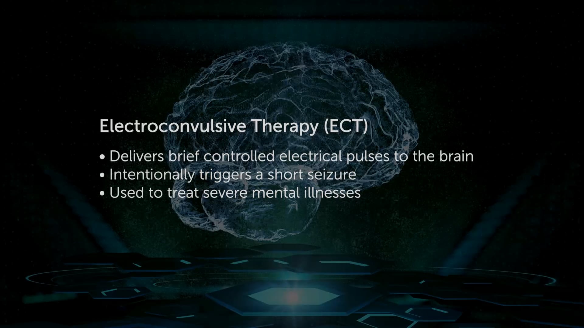 Electroconvulsive Therapy (ECT) Patient Consent | Videos & Movies on Vimeo