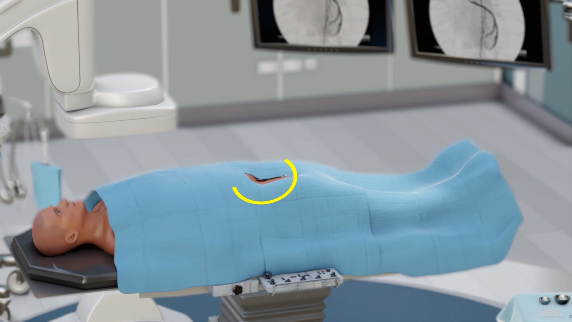 Animated Procedure Video