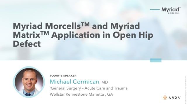 Myriad Matrix™ | AROA