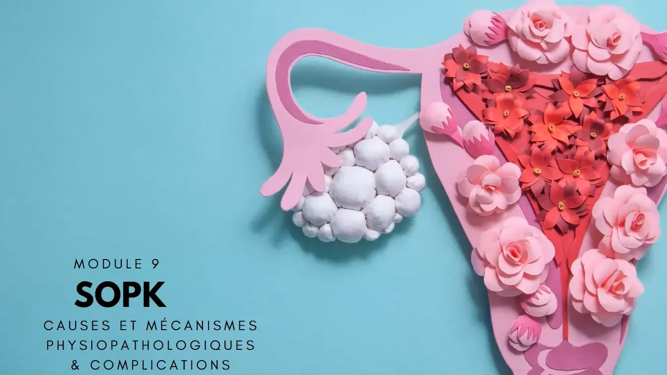 SOPK causes mécanismes et complications