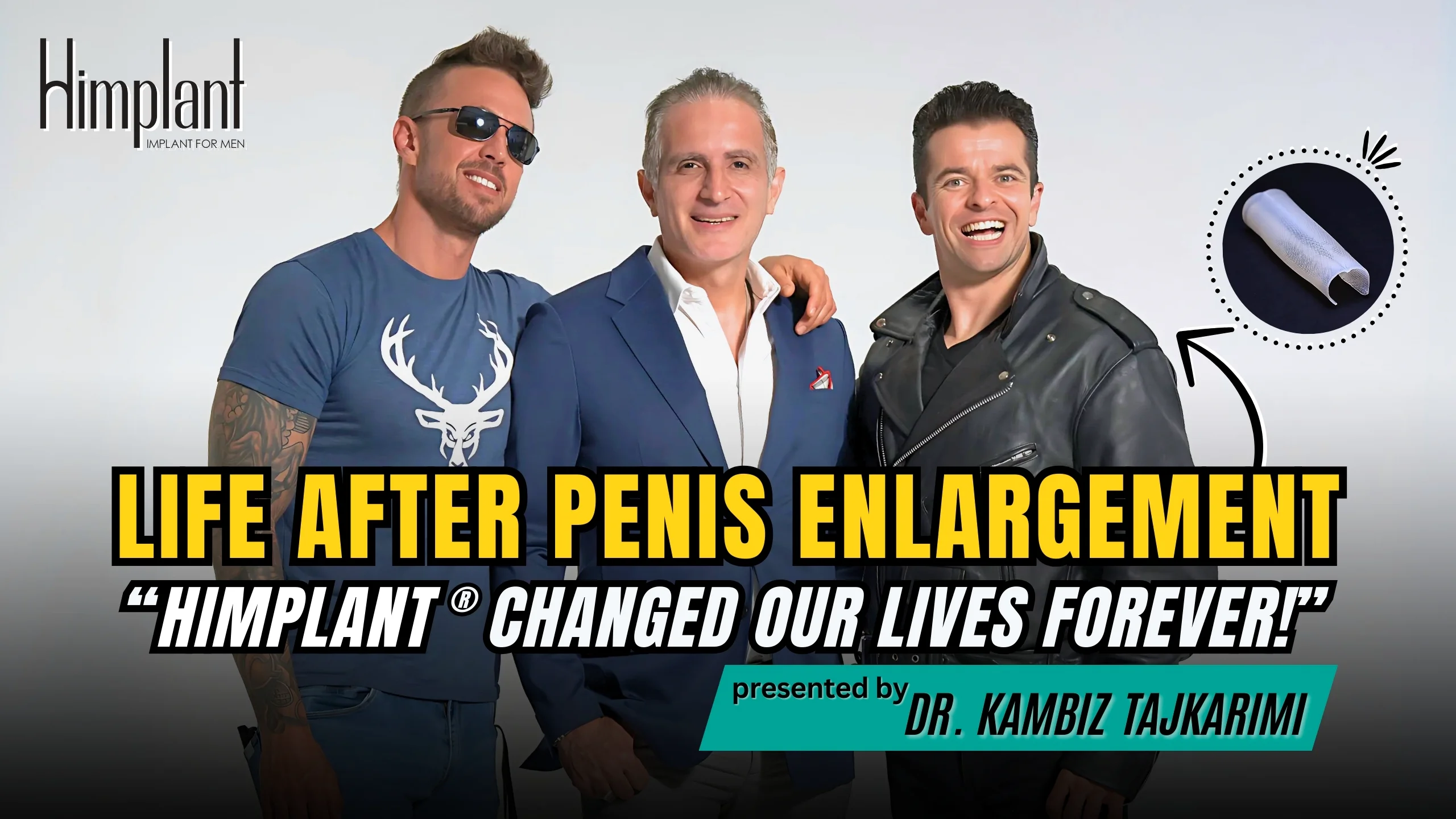 "HIMPLANT® Penis Enlargement Changed Our Lives!" - Real Patient Stories ...