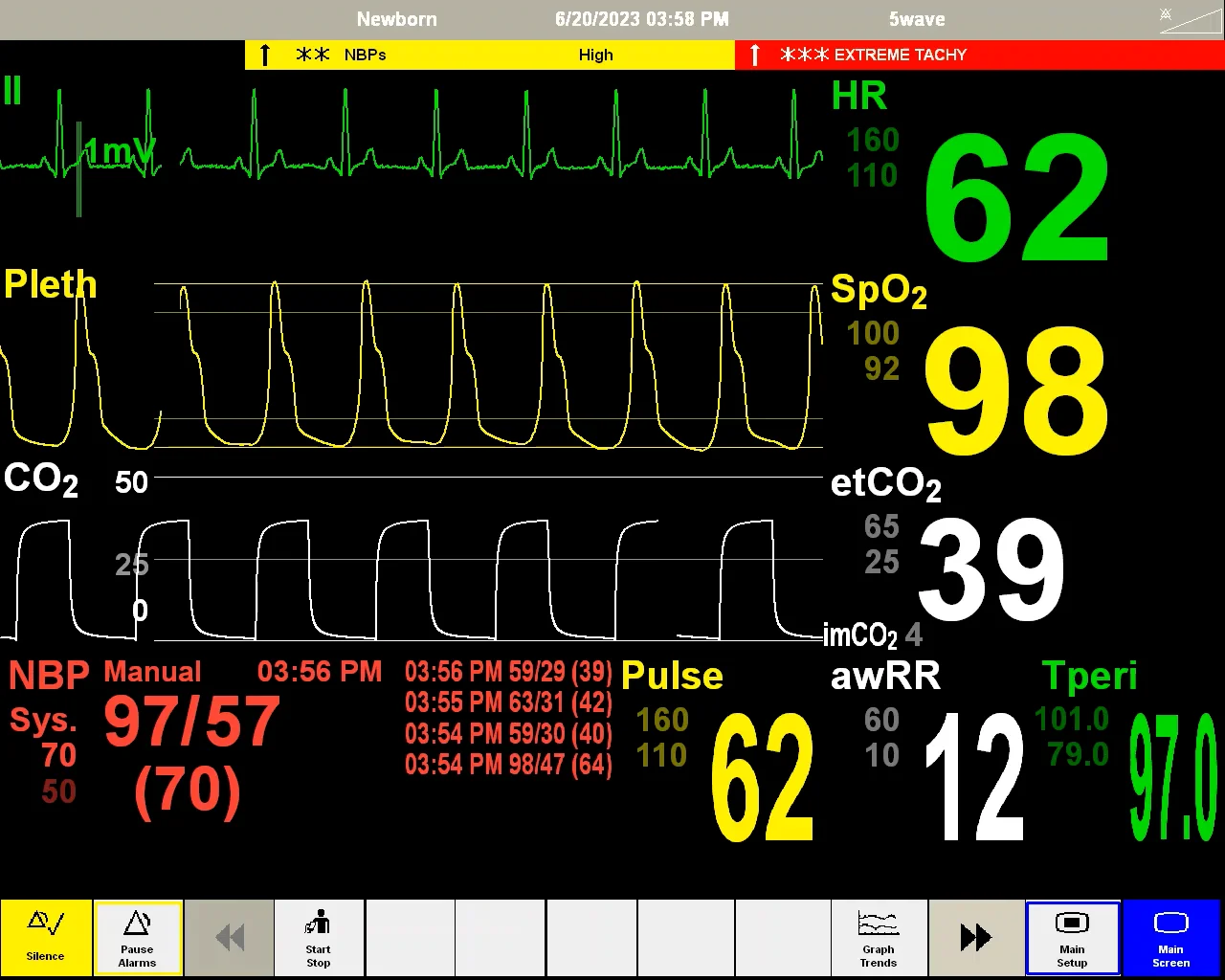 Stage 1 ETCO2 good CPR
