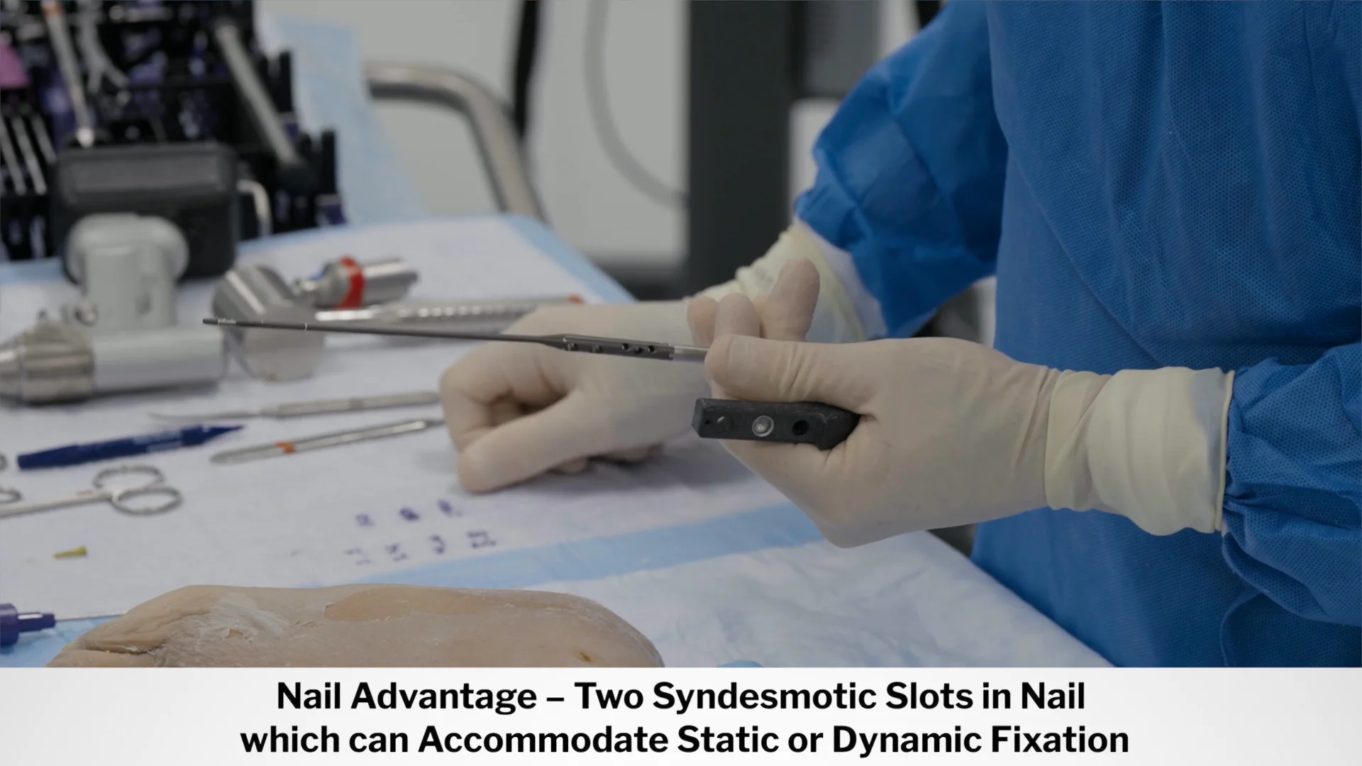 Phantom Fibula Nail System - Features and Benefits - Surgical Video ...