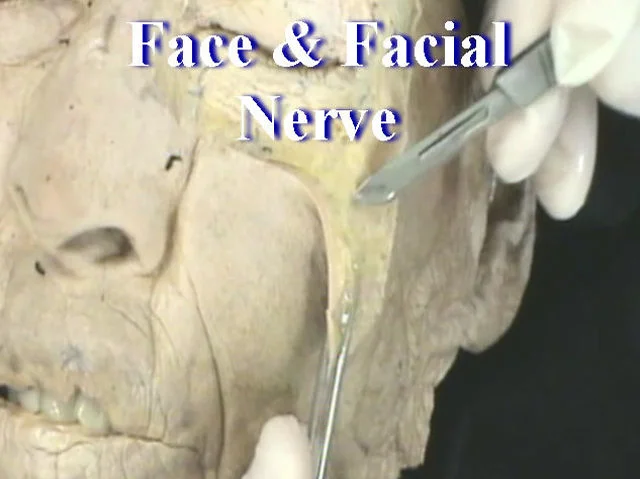 Mandibular Nerve Cadaver