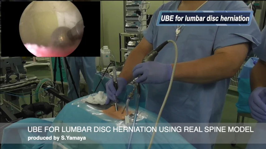 UBE training using the Real Spine model (Video for 5 min)