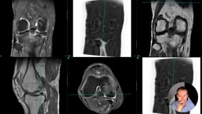 value of bone MRI (synthetic CT) · MSK Radiology