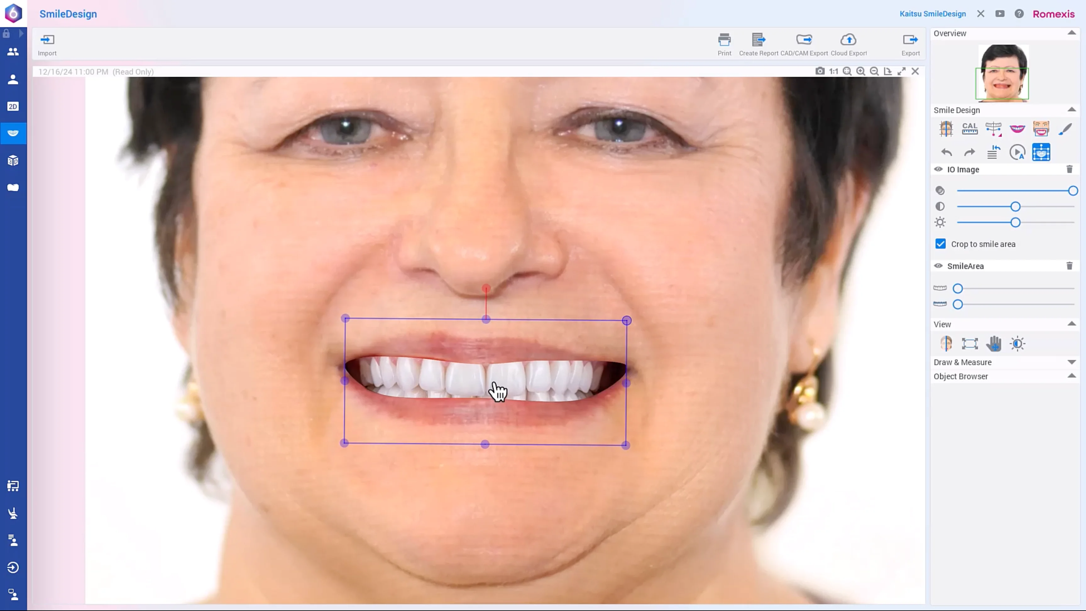 How to - Do smile simulation with the teeth photo