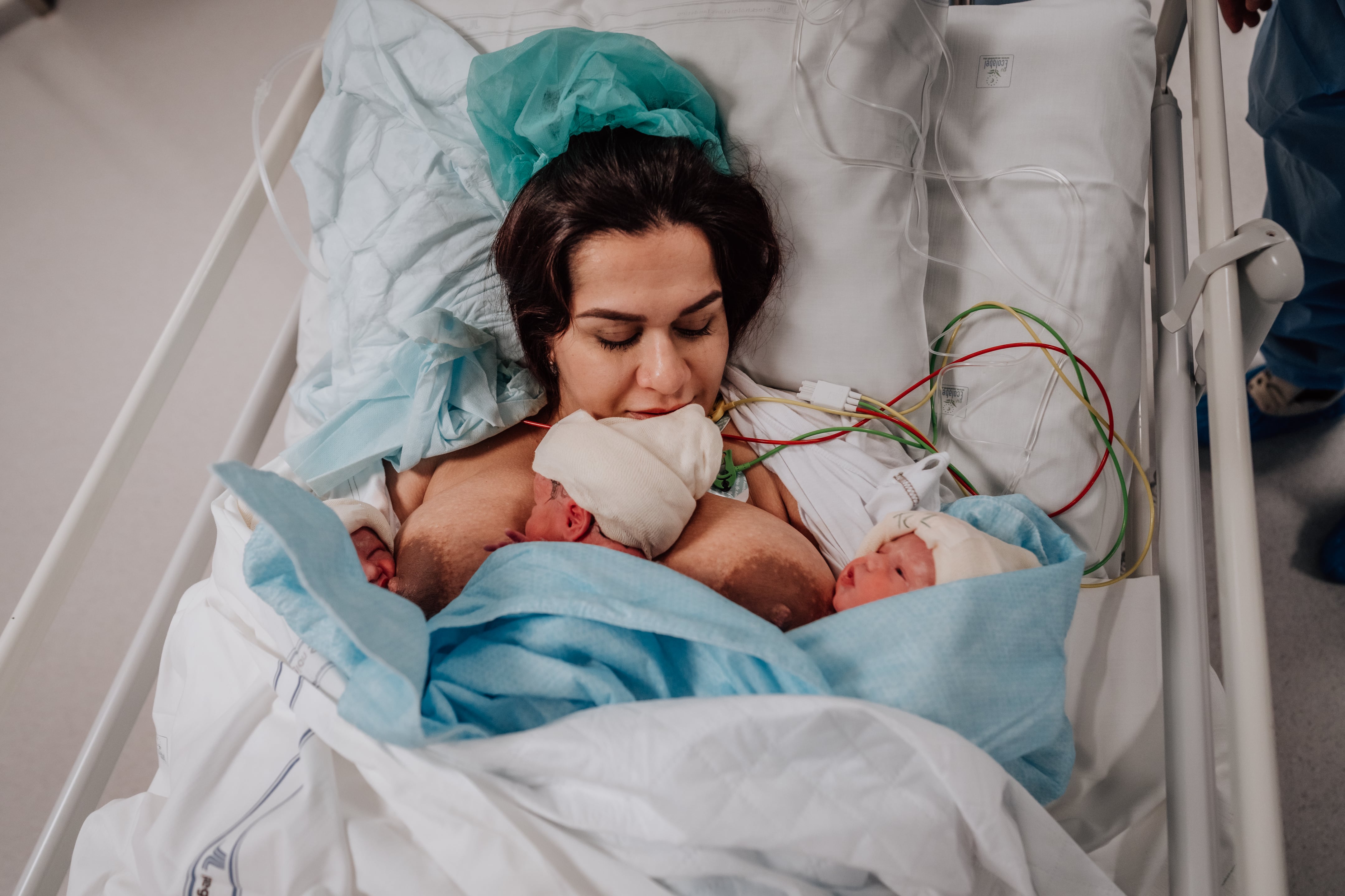 Triplet Birth story