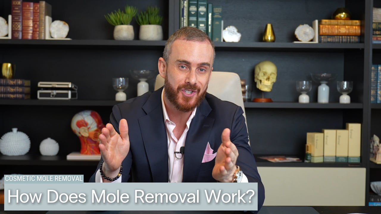 Mole Removal Sydney | Remove Moles with No Scar | Cosmetic Doctors