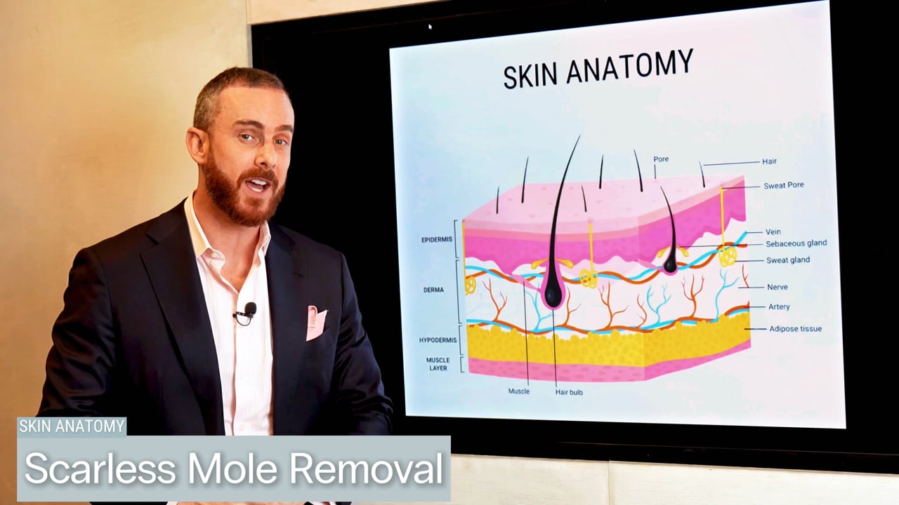 Mole Removal Sydney | Remove Moles with No Scar | Cosmetic Doctors