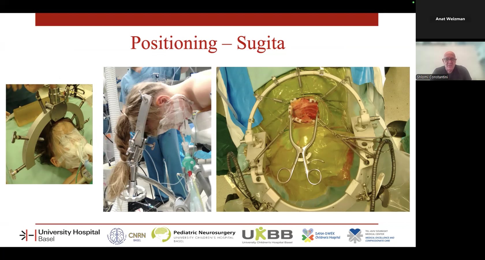 Midline Approach to the Posterior Fossa - ISPN Library