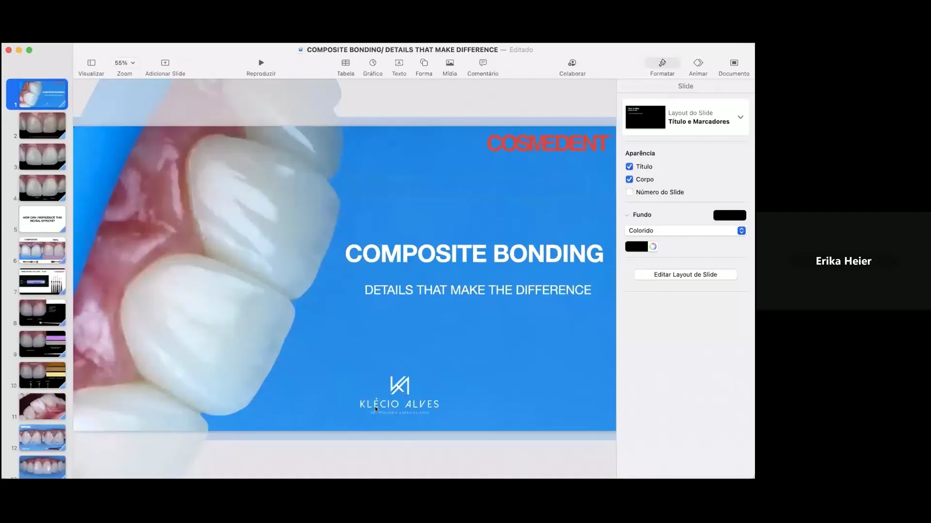 Webinar - Composite Bonding: Details that Make the Difference
