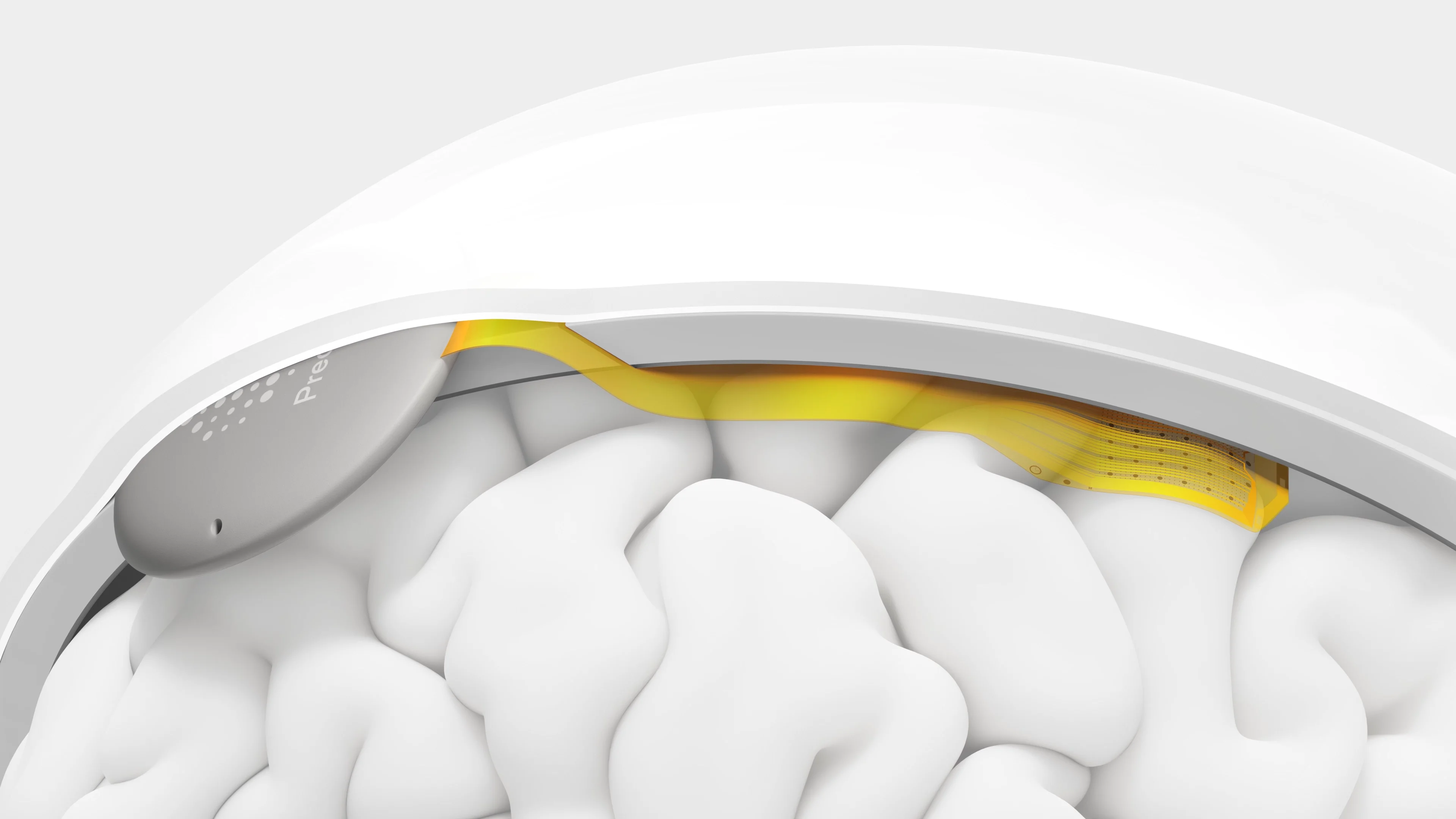 Precision Neuroscience System Overview