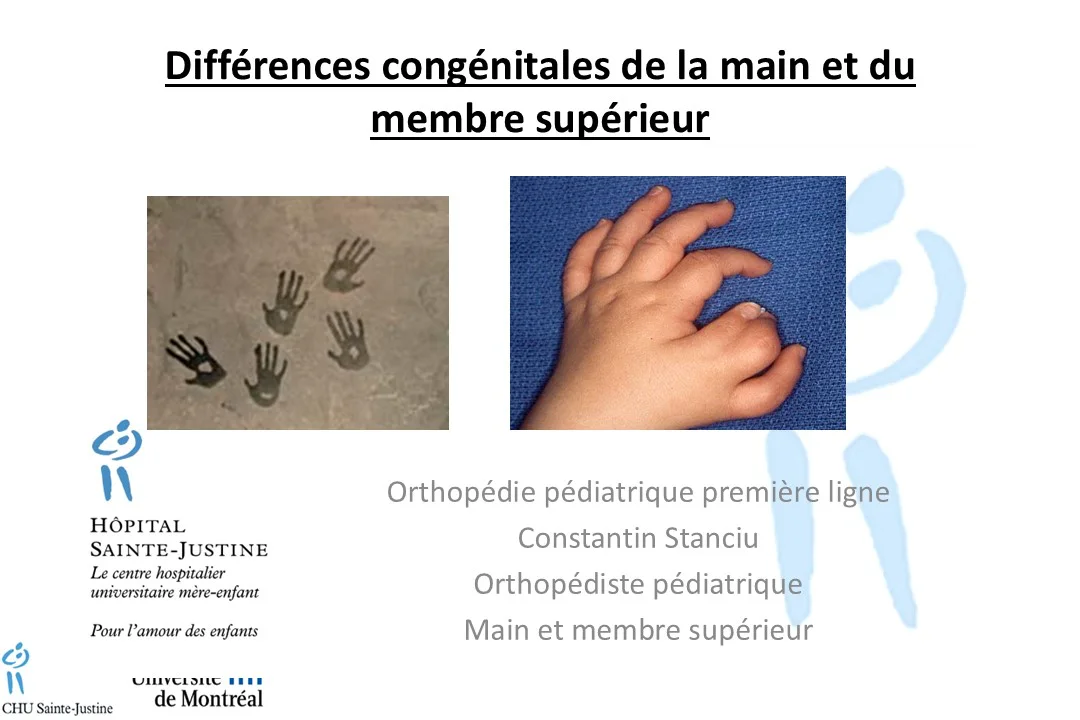 11. Différences congénitales de la main - Dr Constantin Stanciu