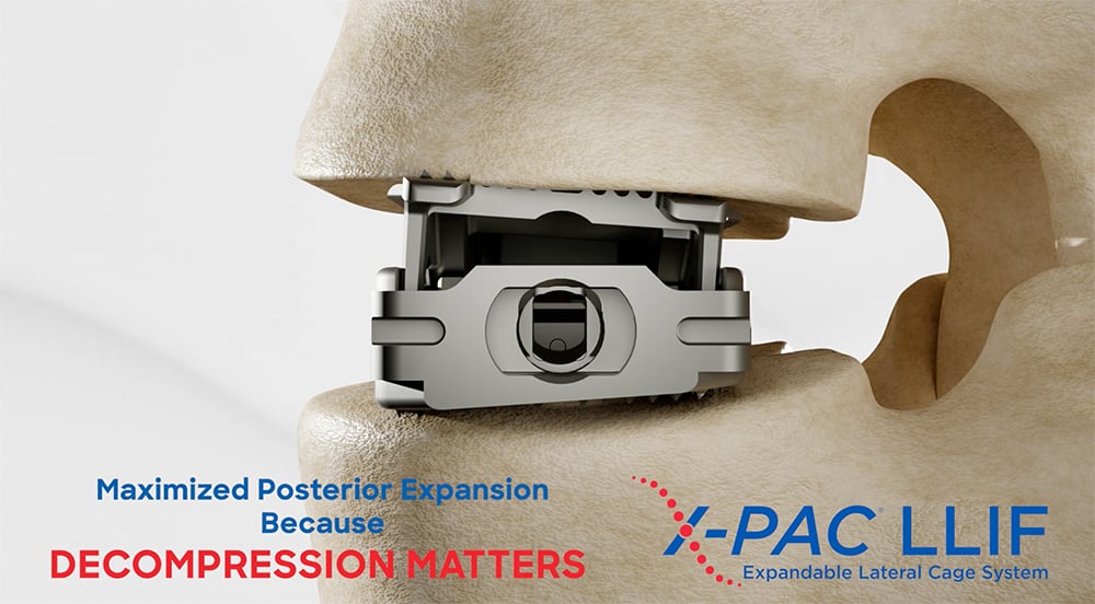 X-PAC Expandable Lateral Cage System - Expanding Innovations