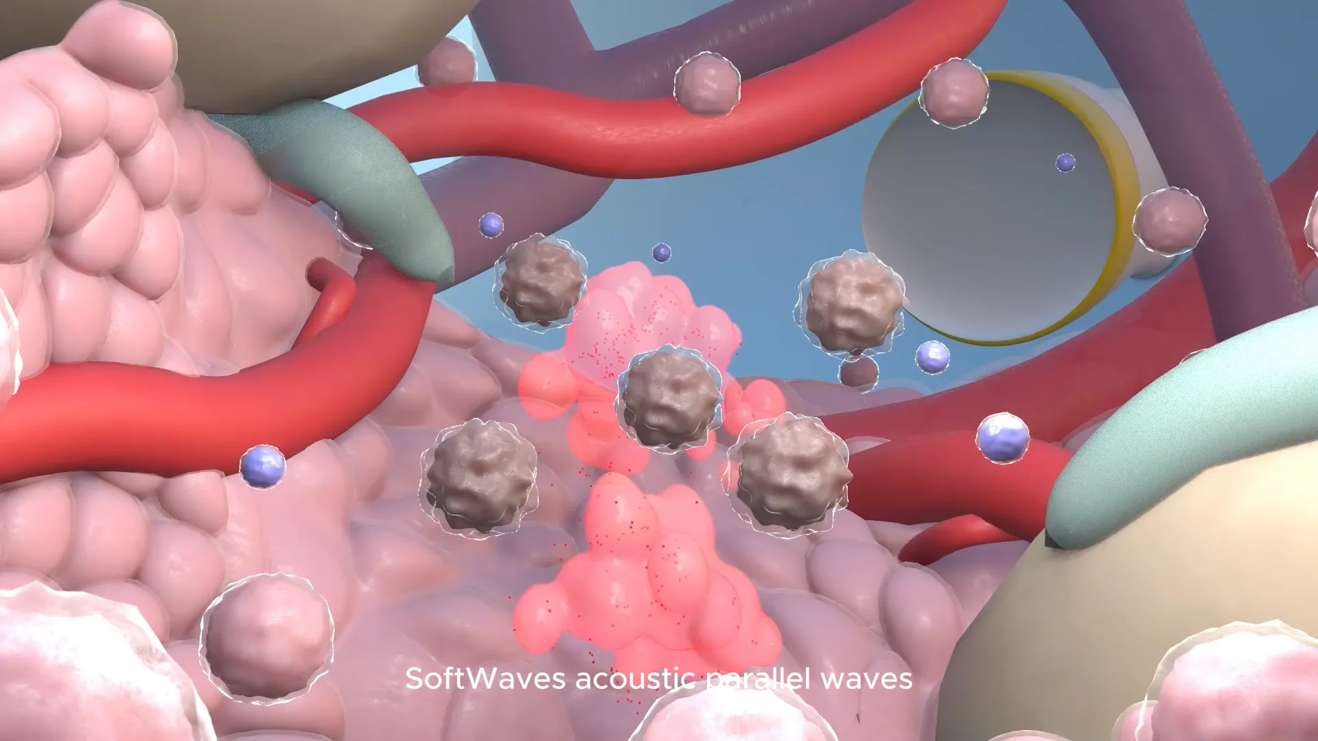 How does SoftWave work?