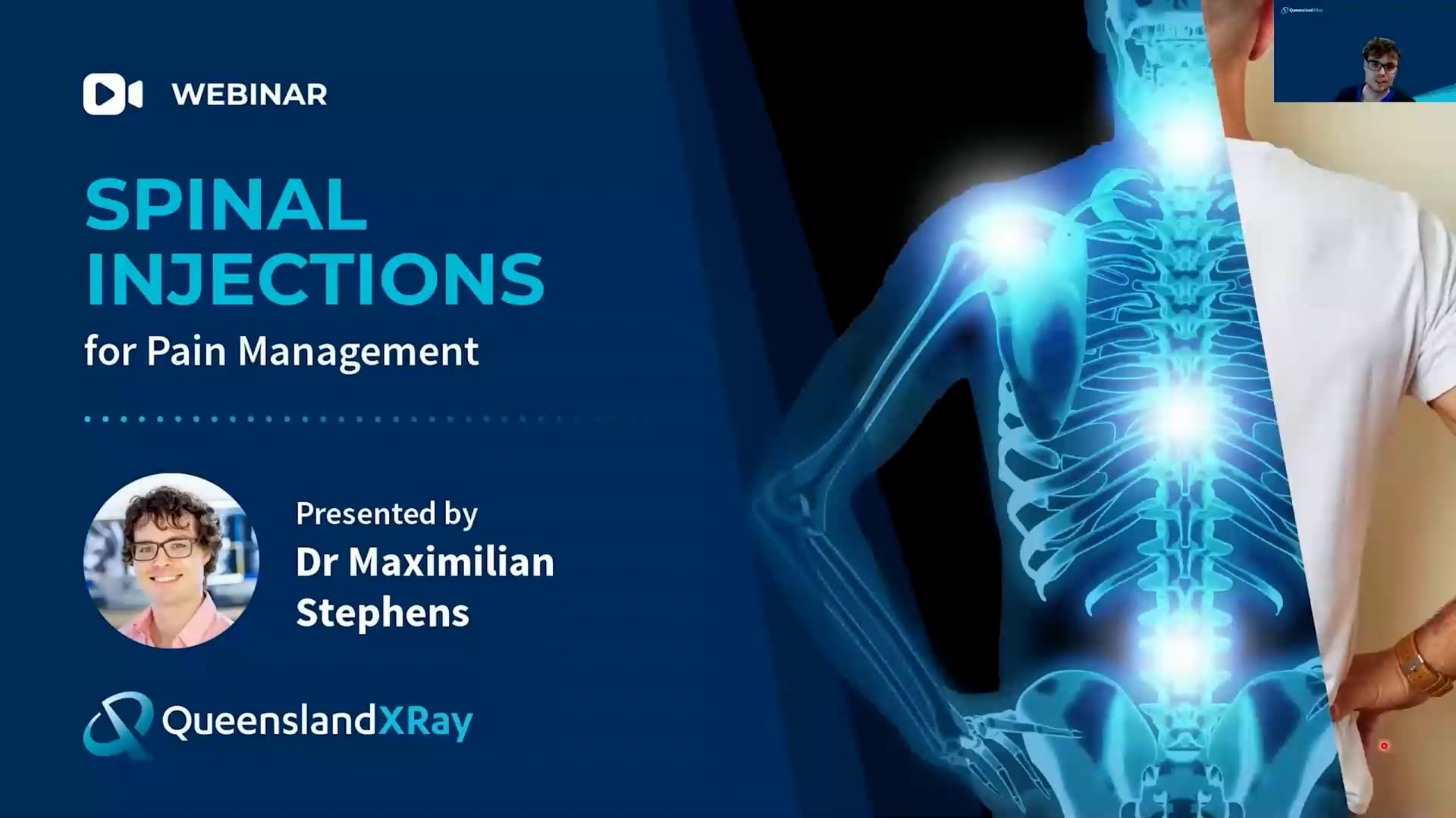 Spinal Injections for Pain Management