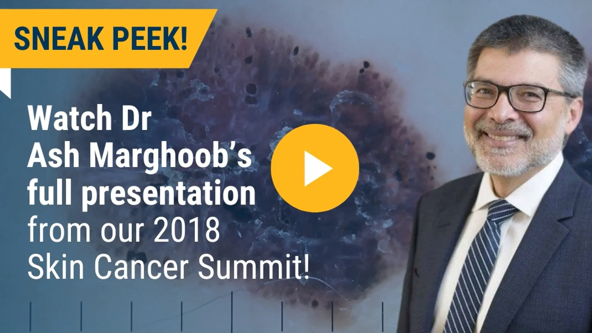 Summit session with Dr Ash Marghoob