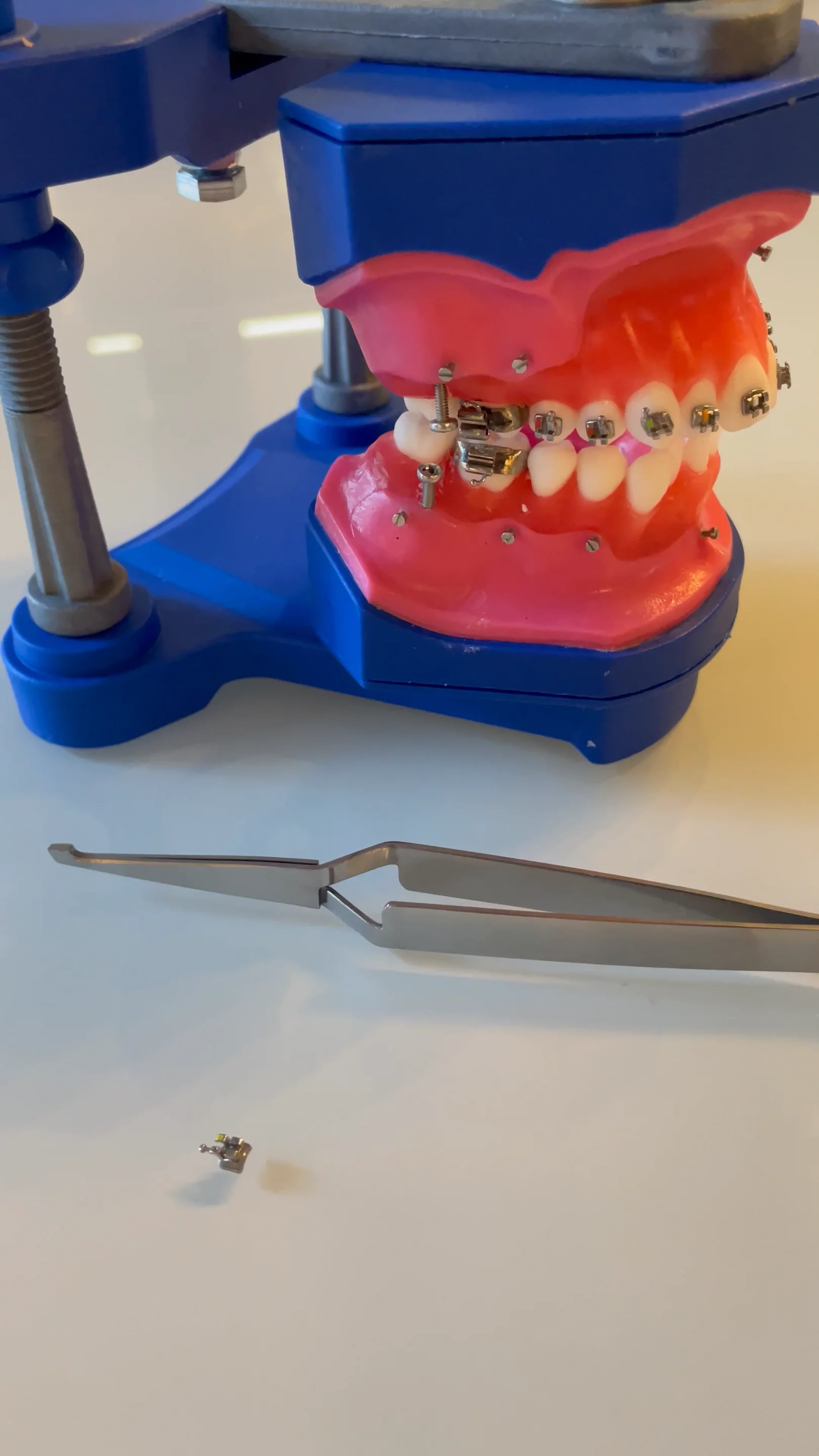 Colagem de braquetes