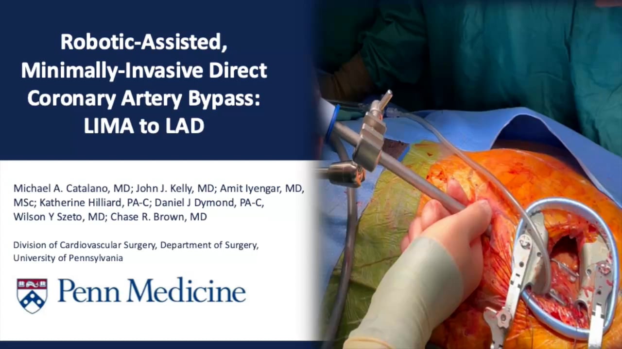 Robotic-assisted, minimally invasive direct coronary artery bypass ...