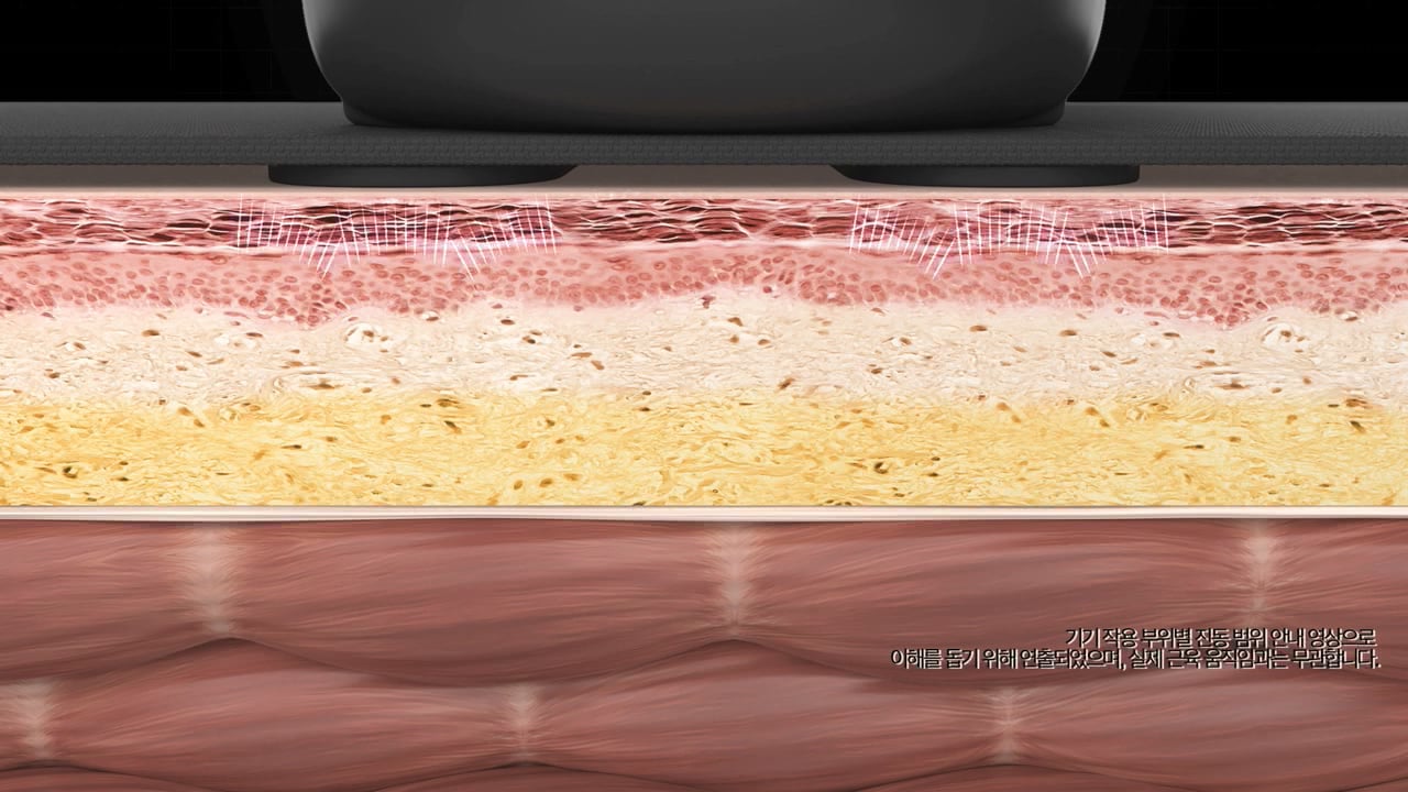 PMD_Lifting_Massage_Band_dermal stimulation 3D