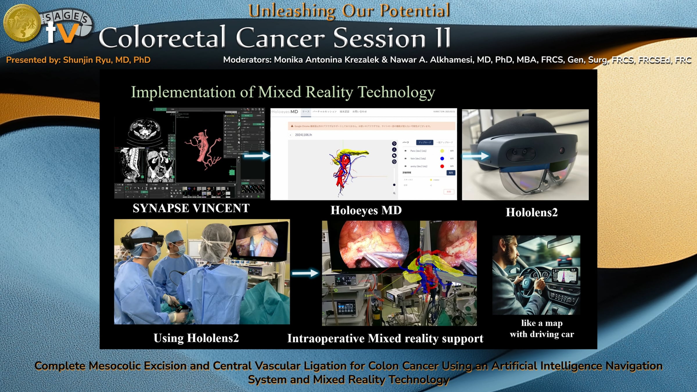 Complete Mesocolic Excision and Central Vascular Ligation for Colon ...