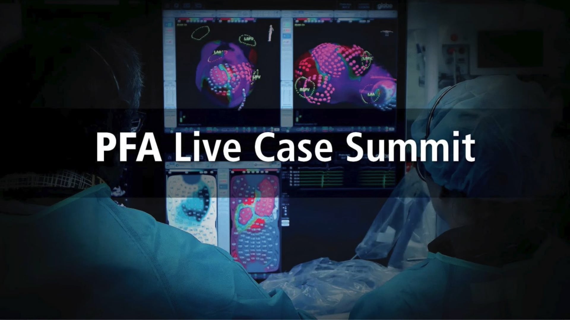 PVI+PWA Using Nanosecond PFA (nsPFA™; Pulse Biosciences Inc.)