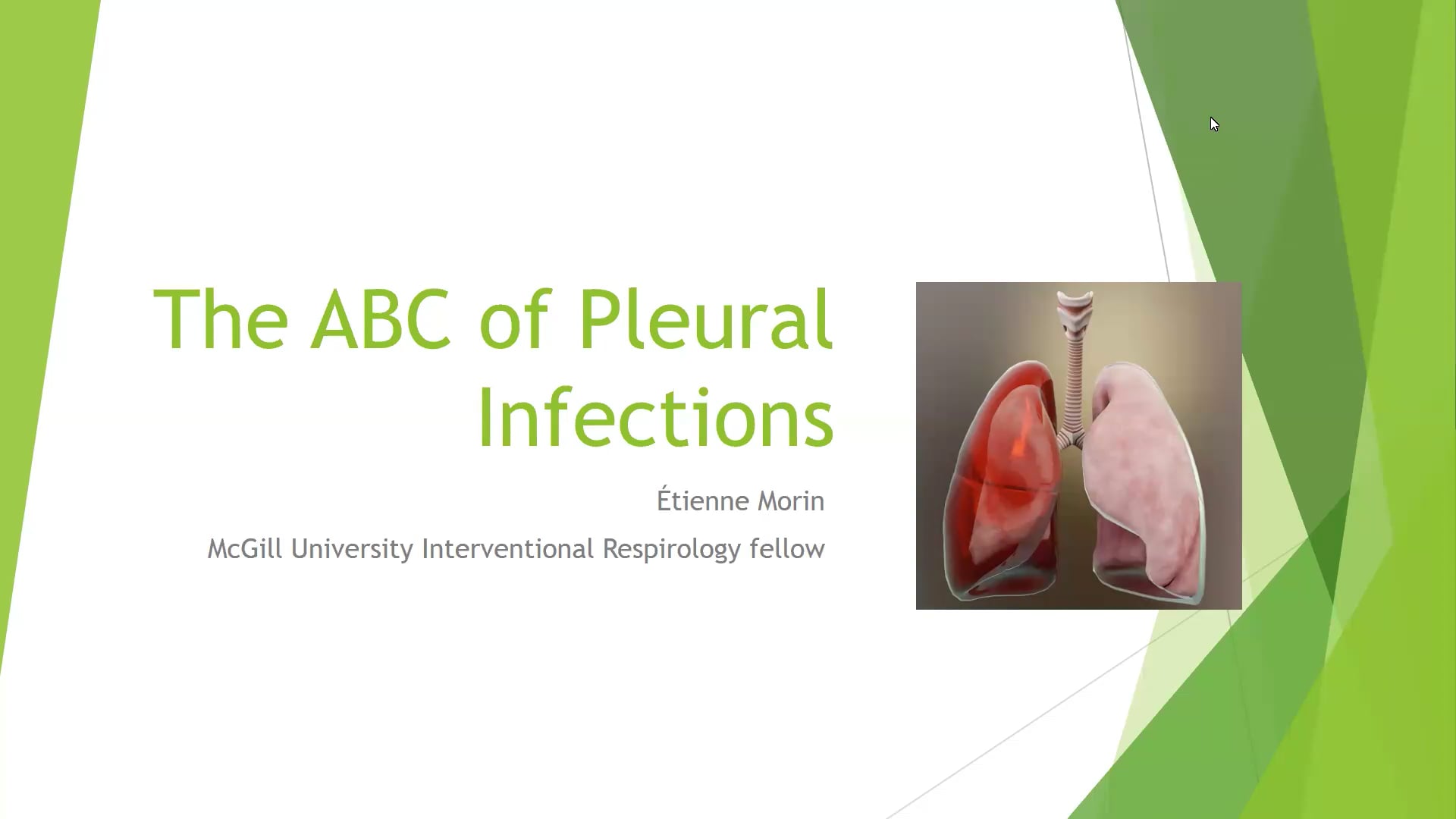 The ABC of Pleural Infections