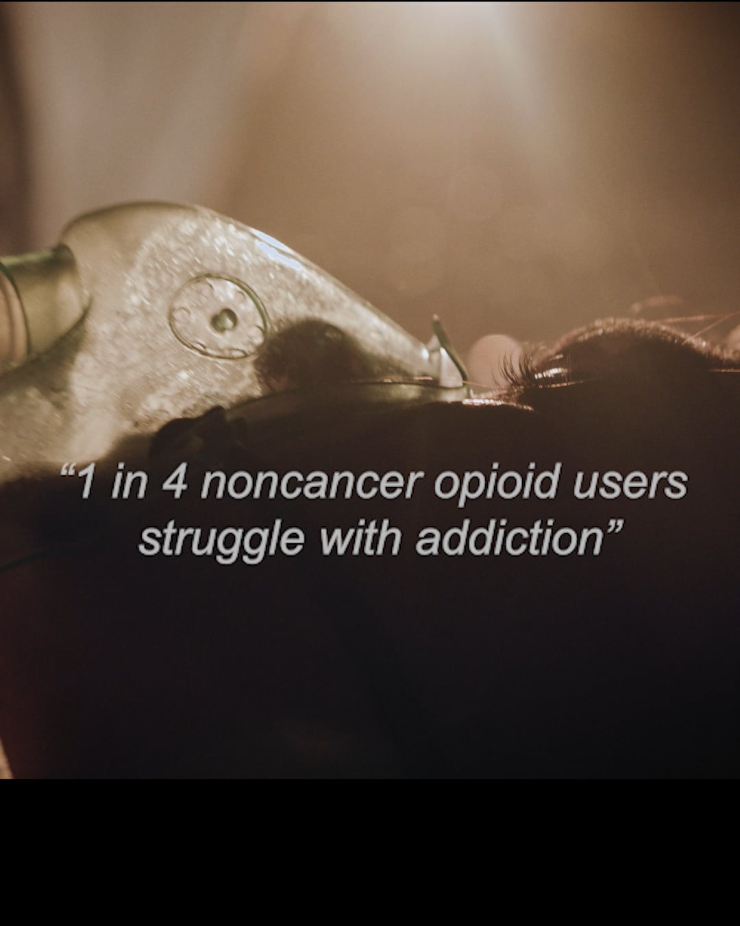 "Over The DOSE" | Reel 2 (4x5)