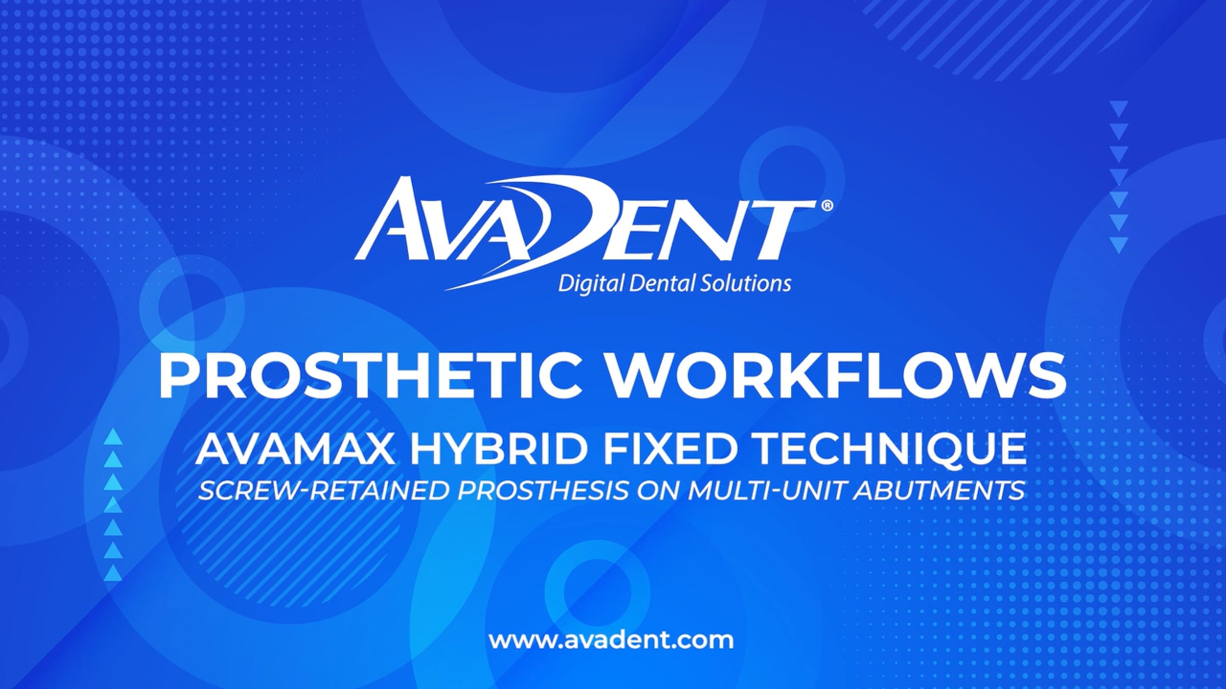 AvaDent Prosthetic Workflows: AvaMax Hybrid Fixed Technique
