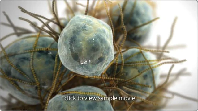 Connective Tissue Disease - Medical Animation on Vimeo