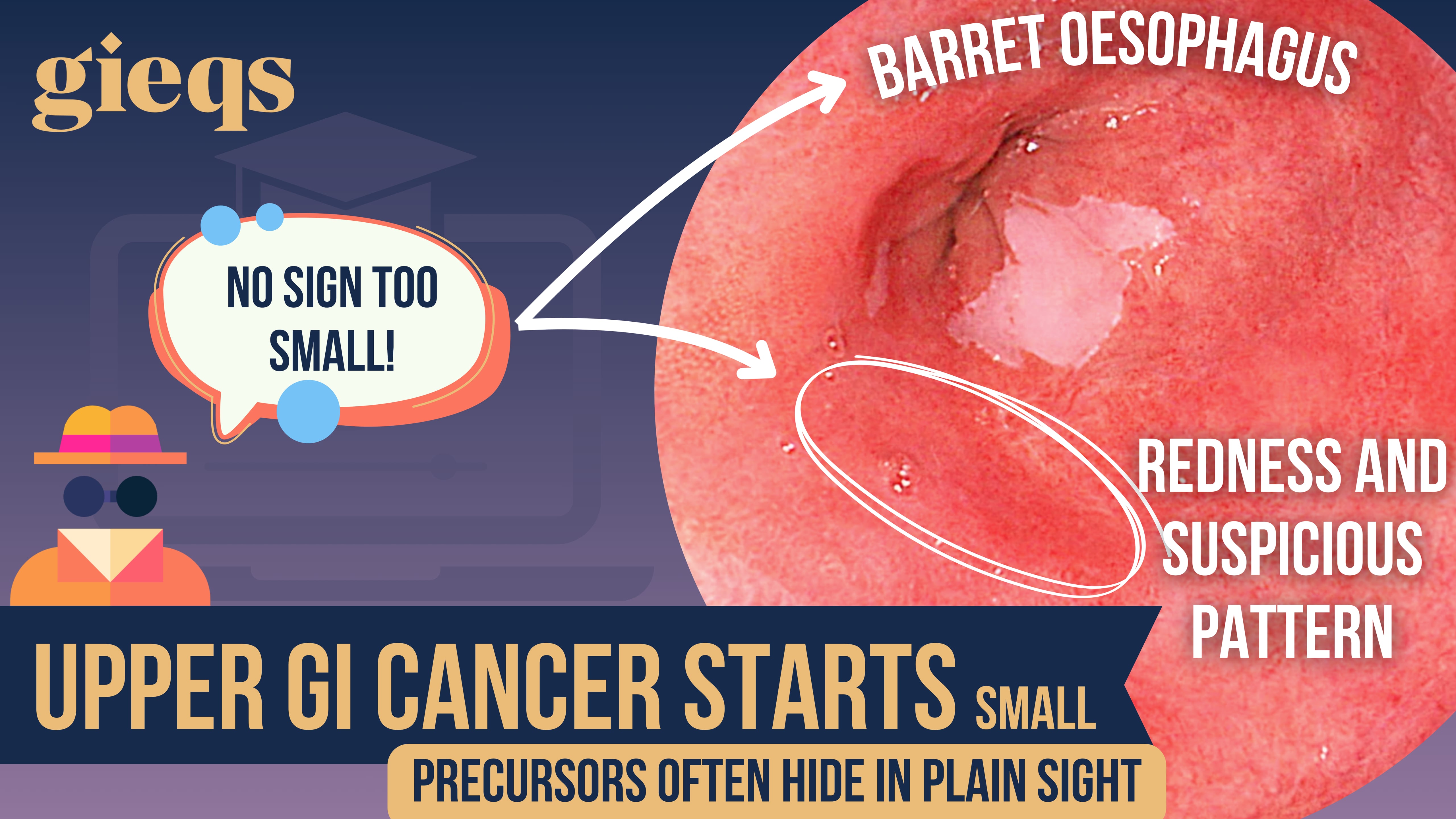 Upper GI Cancer Starts Small — Learn to Spot It | GIEQS VI Video
