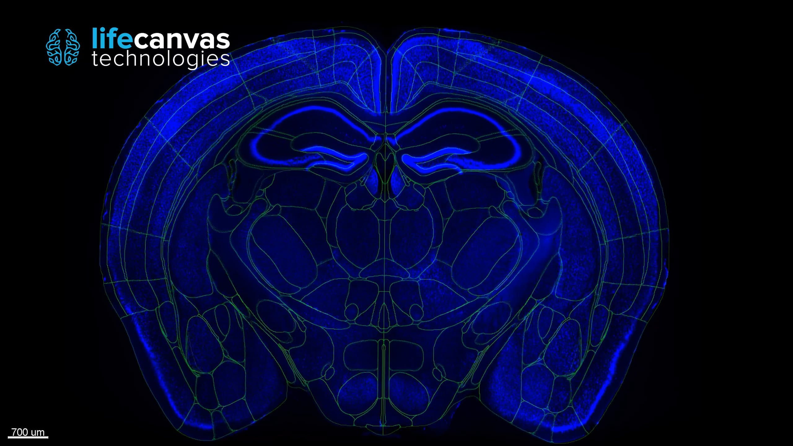 NeuN immunolabeling in mouse brain, warped to the Allen Brain Atlas ...