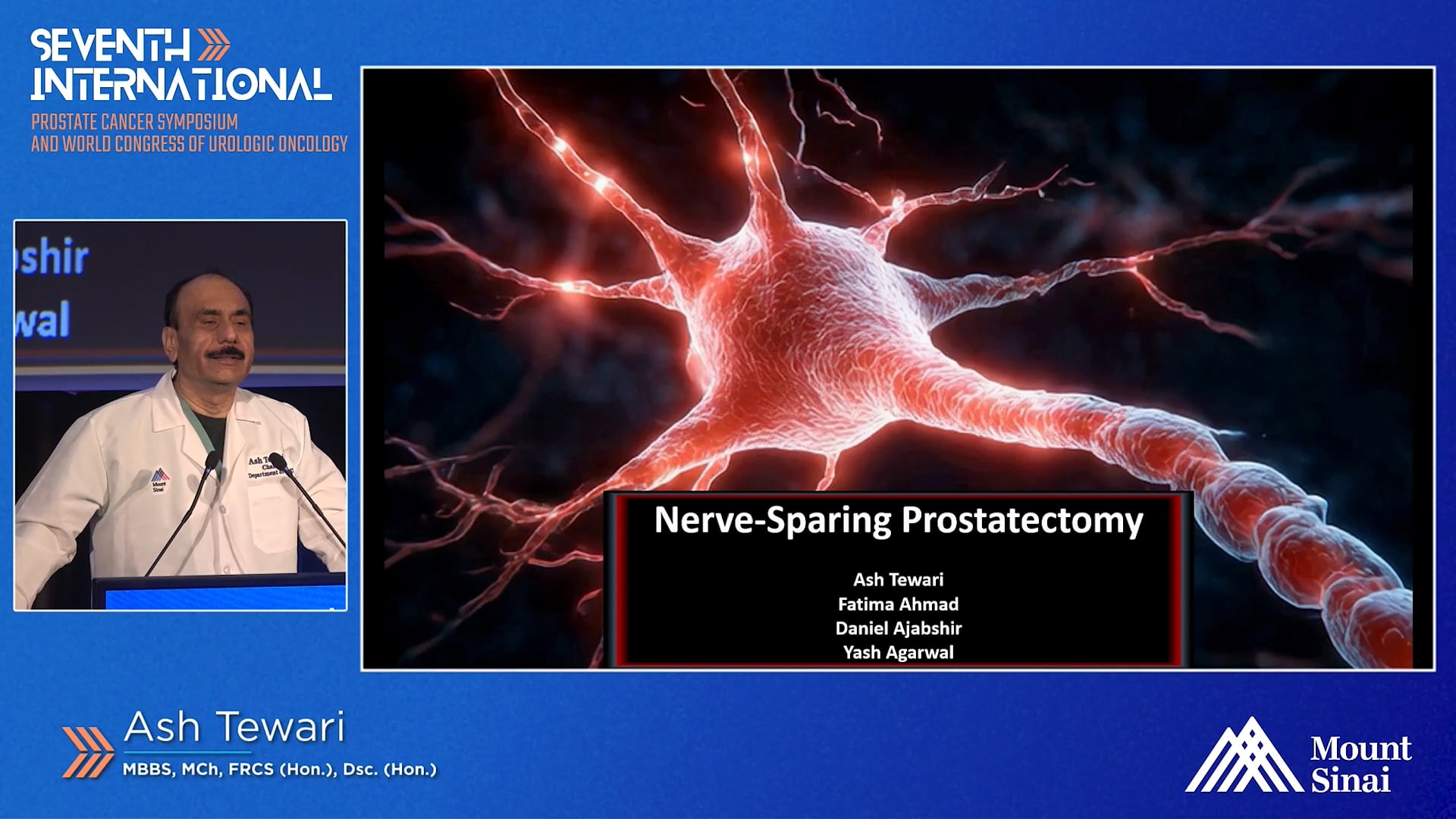 Secret Love Affair Between Nerves and Prostate Cancer - Insights from ...