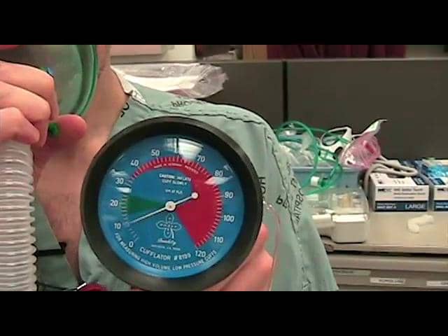 BVM with PEEP Valve and Nasal Cannula on Vimeo