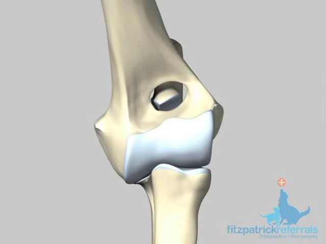 How To Make An Elbow Joint Model