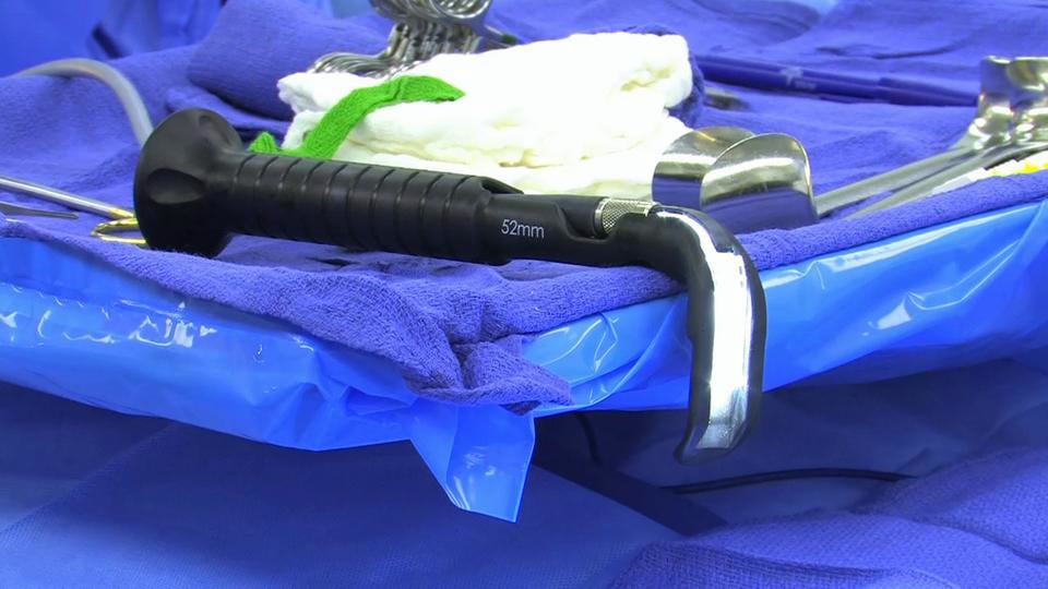 Invuity’s Eigr™ Illuminated Breast Retractor System on Vimeo