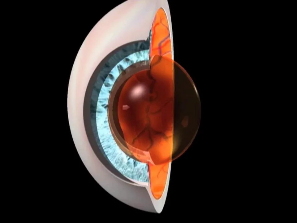 Cataract surgery animation on Vimeo