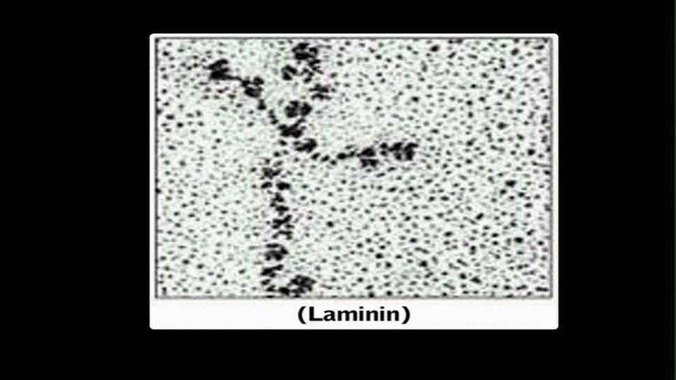 Louie Giglio Laminin Sermon Illustration on Vimeo