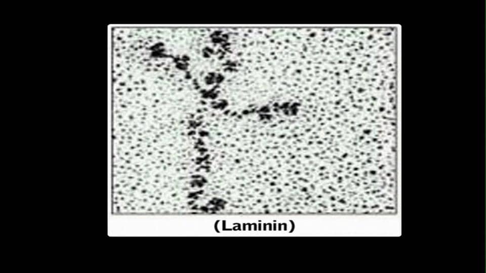 Louie Giglio Laminin Sermon Illustration on Vimeo