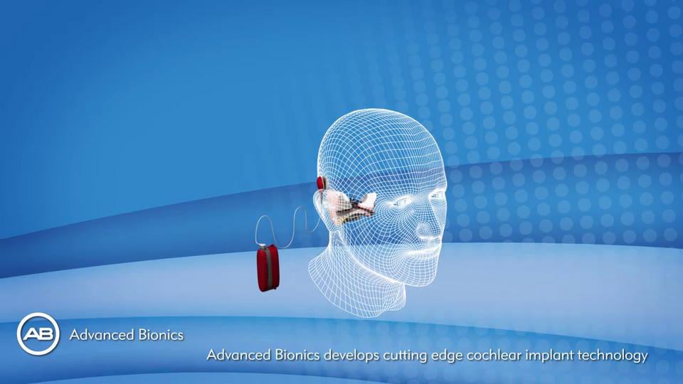 Advanced Bionics HiResolution Bionic Ear system: HiRes90K cochlear ...