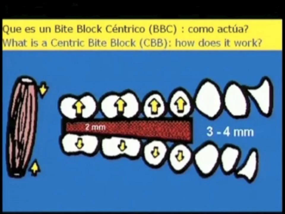 Bite Block Centrico
