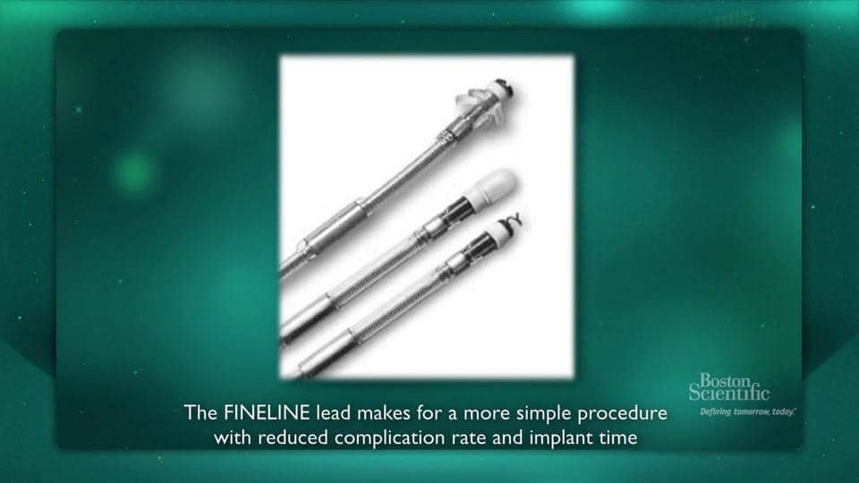 Boston Scientific FINELINE II implant video on Vimeo