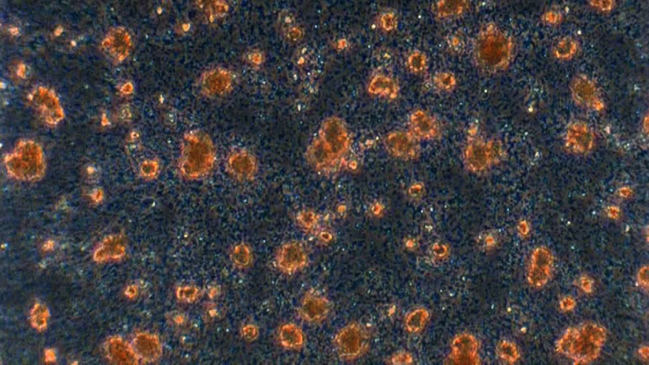 Sponges: Time-lapse of Sponge Cells Recombining on Vimeo