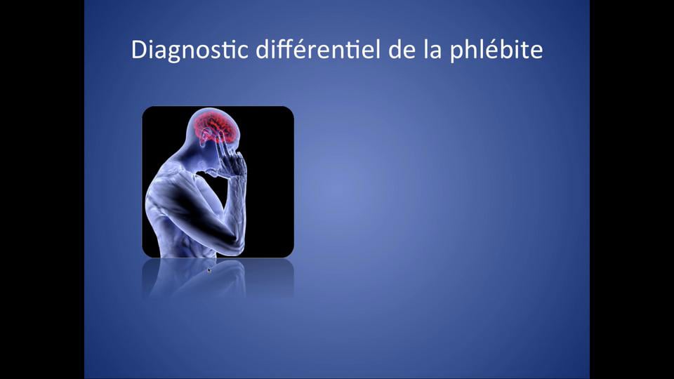 Les anticoagulants et le traitement des phlébites, partie 1 on Vimeo