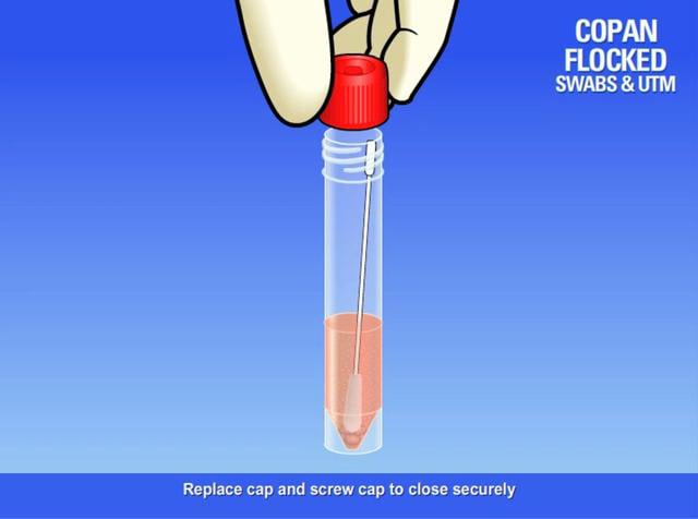 COPAN UTM and Flocked Swabs for Nasopharyngeal Sample Collection ...