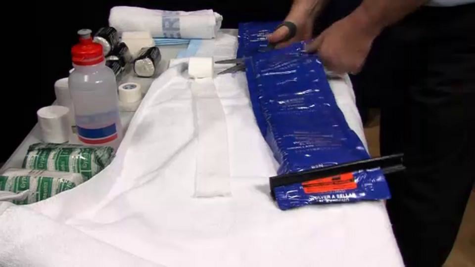 Fibreglass Above Elbow Backslab on Vimeo