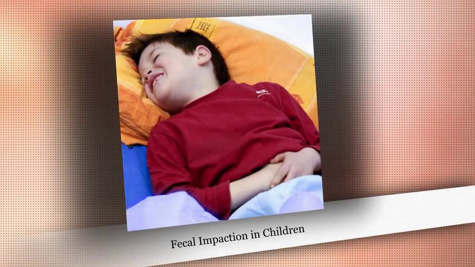 Fecal Impaction in Children on Vimeo